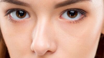 Exploring Different Types of Nose and Shapes for Women and Men